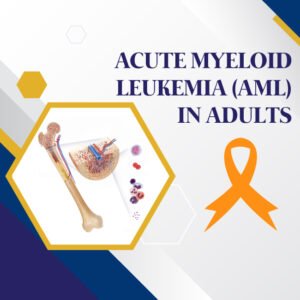 Acute Myeloid Leukemia (AML) in Adults - UHAPO