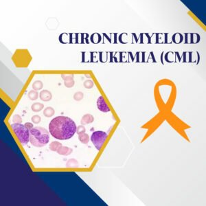 Chronic Myeloid Leukemia (CML): Comprehensive Guide