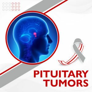 Pituitary Tumors, Signs and Symptoms | Uhapo