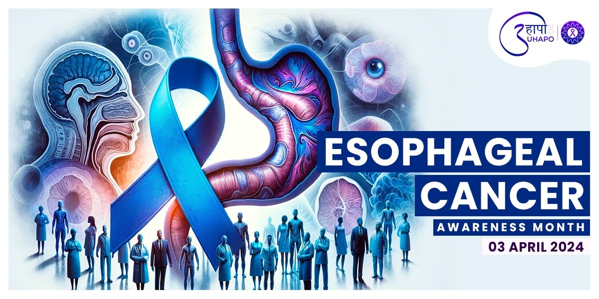 Esophageal Cancer Awareness: Uhapo Initiative Strategies